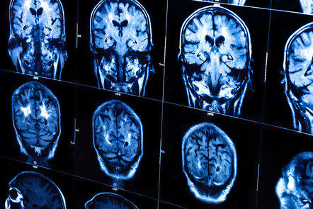 Good Brain, Bad Brain: Basics